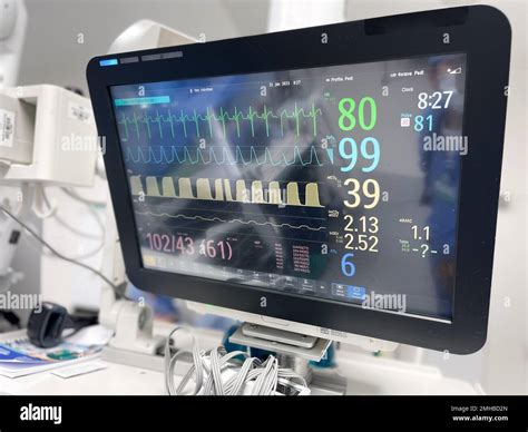 How To Read Oxygen Level On Hospital Monitor At Nate Piquet Blog