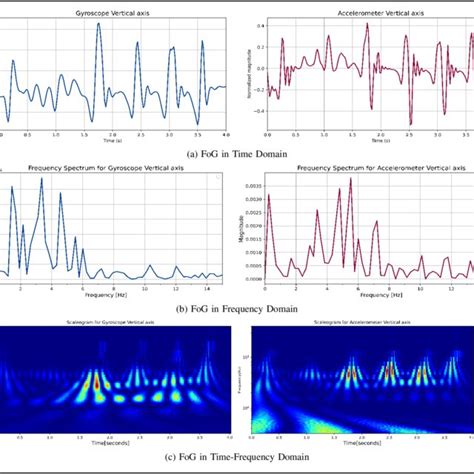 Non Fog Gait Signals Visualised In Time Frequency And Time Frequency Download Scientific