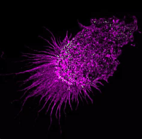 Gallery Cancer Immunology And Immunotherapy Zhou Lab Westlake U