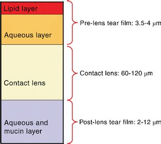 Dry Eye And Contact Lenses Ento Key
