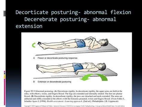 Lisa Randall Rn Msn Acns Bc Rnsg Objectives Define Cerebrovascular Accident And Associated