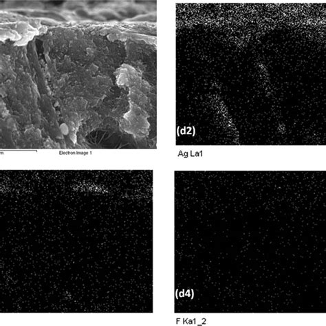 Element Mapping Analysis Of The Cross Sectional Surface Of A Dentin Download Scientific Diagram