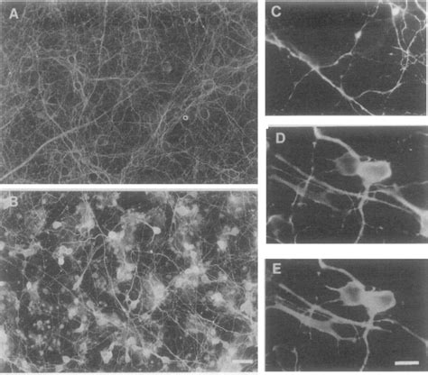 neurofibrillary tangle assembly semantic scholar