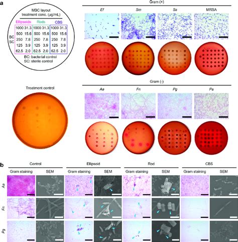 A General Mbc Layout With Different Treatment Concentrations μg Ml Download Scientific