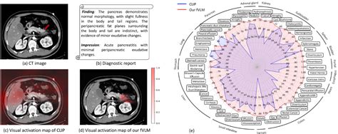 논문 리뷰 Large scale and Fine grained Vision language Pre training for Enhanced CT Image