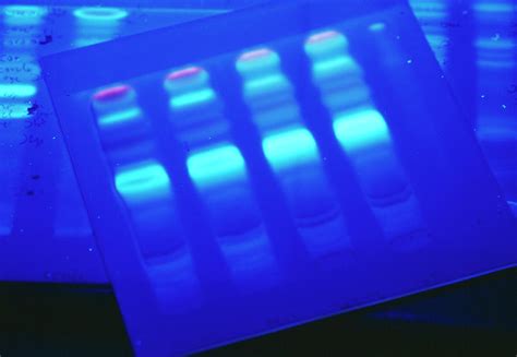 Dna Electrophoresis By Science Photo Library