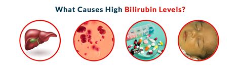 High Bilirubin Levels Hyperbilirubinemia Symptoms Causes Tests And Treatments