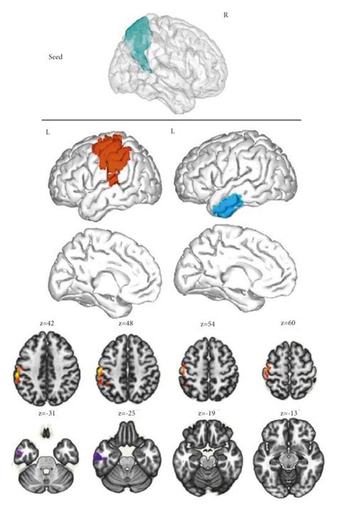 Functional Connectivity Analysis Based On The Region Of Interest Download Scientific Diagram