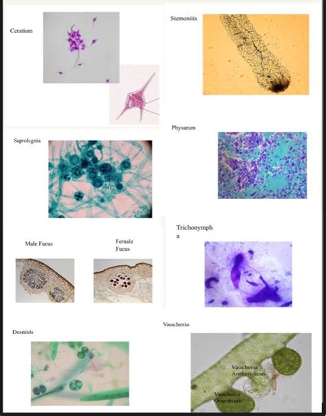 Solved Study The Slides Of Protists That Are Evailable In
