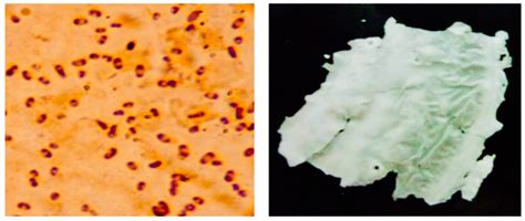Repeated Fed Batch Culture Strategy For The Synthesis Of Polyhydroxybutyrate Phb Biopolymers