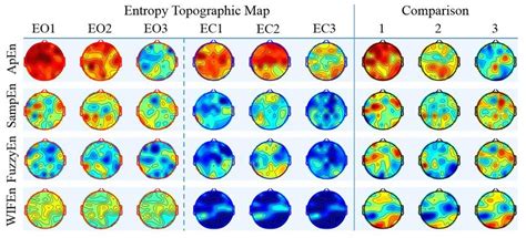 The Left Part Is A Visualization Of The Topographic Distribution Of EEG Download Scientific