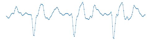 LPCNet DSP Boosted Neural Speech Synthesis Mozilla Hacks The Web Developer Blog