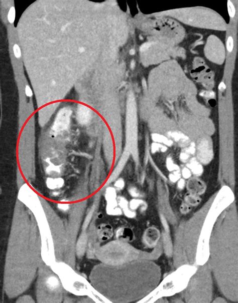 Diagnostic Imaging Toronto Notes