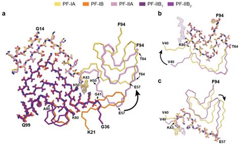 Structures Of α Synuclein Filaments From Multiple System Atrophy Pmc