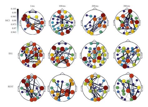 Functional Brain Networks At 1 100 200 And 300 Ms During Mci Ieg Download Scientific