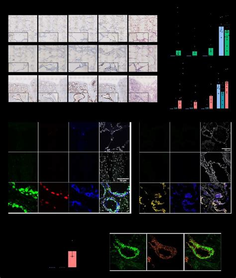 Basal Cell Marker Expression Increases With Pathological Aging In The Download Scientific