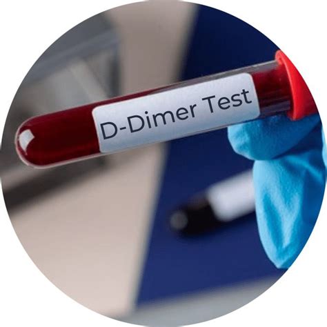 China Cheap D Dimer Test Kit Manufacturers Suppliers D Dimer Test Kit