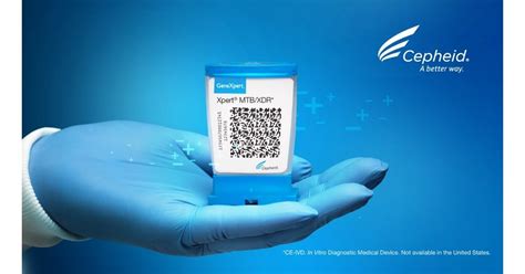 New Rapid Molecular Test For Tuberculosis Can Simultaneously Detect