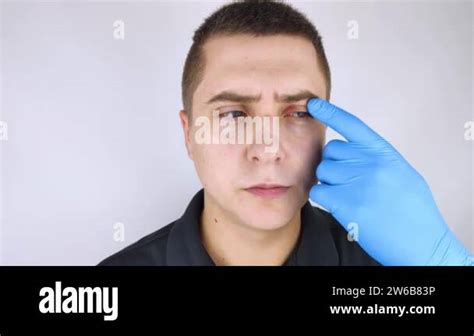 A Doctor Examines A Patient Who Has Blepharitis Treatment Of