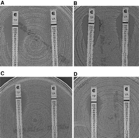 Teicoplanin Tp And Vancomycin Va Mics Determined By E Test For E