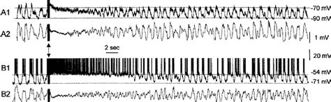 Episodes Of Eeg Desynchronization A1 B1 Evoked By Electrical Download Scientific Diagram