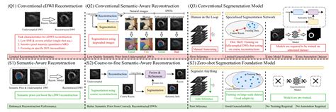 Rsfr A Coarse To Fine Reconstruction Framework For Diffusion Tensor Cardiac Mri With Semantic