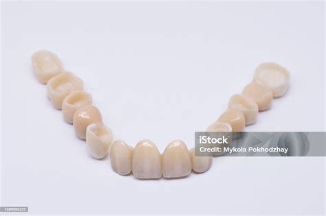 세라믹 도자기로 만든 위트에 고립 된 아름다운 치과 다리 치아 손실의 미적 복원 세라믹 지르코늄 최종 버전 금속 프리 세라믹