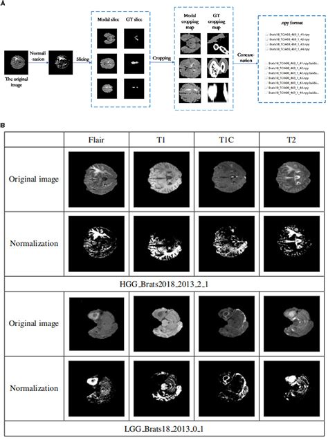 Frontiers Mmgan A Multimodal Mr Brain Tumor Image Segmentation Method