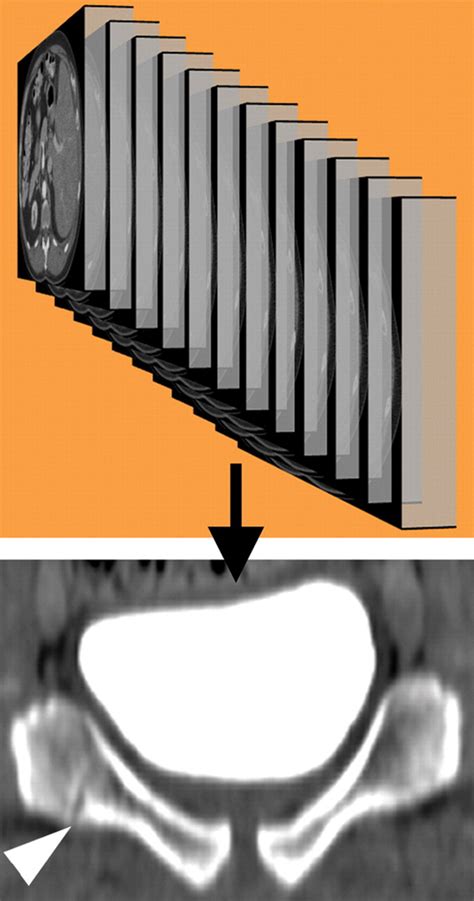 Introduction To The Language Of Three Dimensional Imaging With