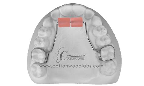 Removable Bluegrass Appliance At Kate Gates Blog