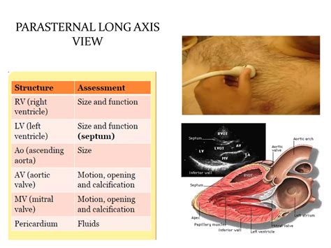 2D ECHO Basics PPTX Digital Audio Computer Software And Applications