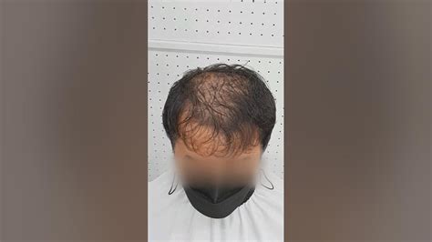 머리숱 없는 사람들이 할수 있는 가장 현실적인 스타일 Youtube
