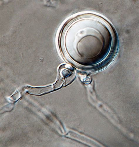 Phytophthora Citricola IDphy