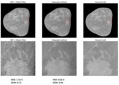 Reconstruction Results On Simulated Breast Phantoms First Column Full Download Scientific