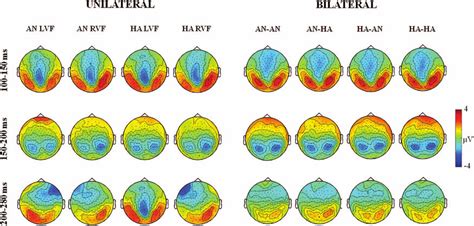 Temporal Evolution Of The Topographic Maps Over The Whole Scalp Of The