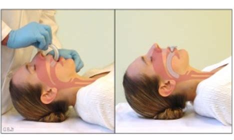 Basic Airway Management Rcemlearning