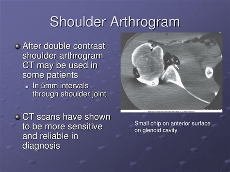Ppt Arthrography Powerpoint Presentation Free Download Id6595294