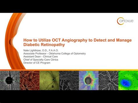 Diabetic Maculopathy Oct