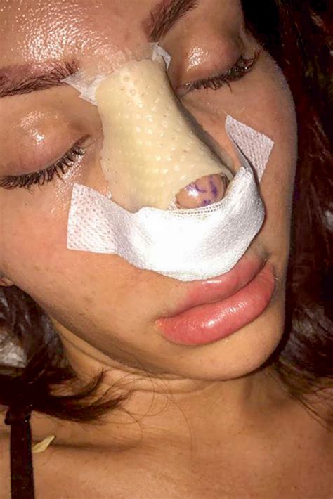 Plastic Surgery Addict Wants A Barbie Vagina So Plans Her Third Vaginoplasty And Shes Already