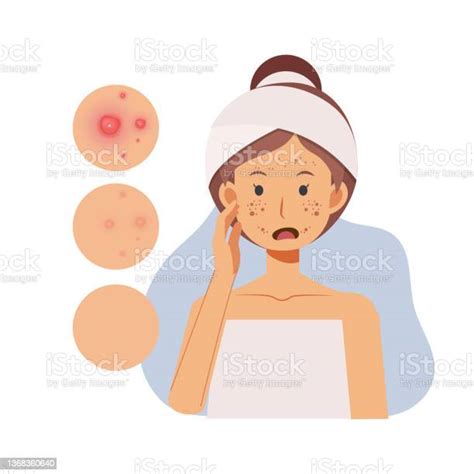 문제 피부 개념 얼굴에 여드름을 가진 여자 얼굴 피부 고민 플랫 벡터 만화 캐릭터 일러스트레이션 쇼크에 대한 스톡 벡터 아트 및 기타 이미지 Istock