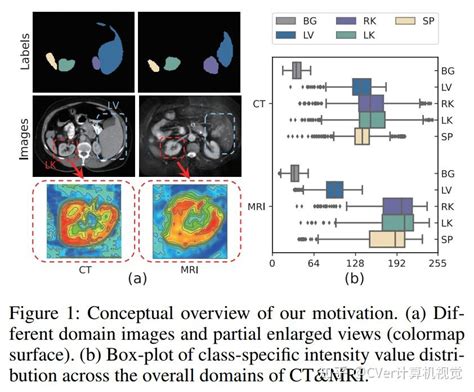 Aaai 2023 Slaug：重新思考医学图像分割中单源域泛化的数据增强 知乎