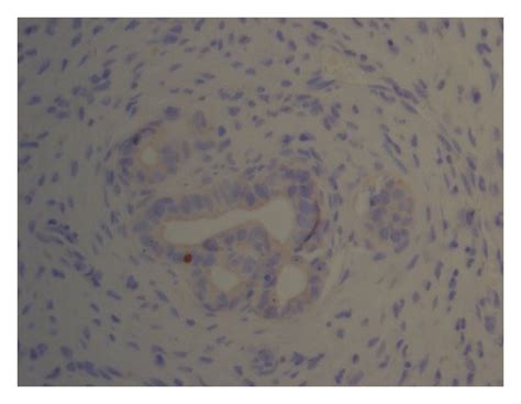 The Expression Of Pr In Eutopic Endometrium Dab Stain ×400 A