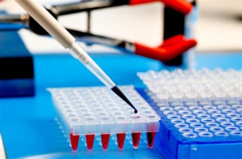 New Genetic Testing For Cardiac Diagnoses