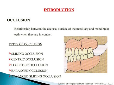 Balanced Occlusion Ppt