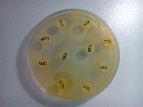 Figure1 The Picture Of A Esbl Producer Li Isolate Download