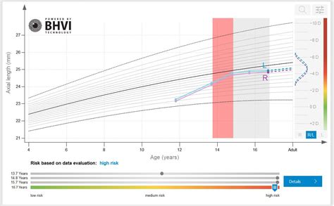 The Oculus Myopia Master Simplifies And Improves Myopia Management
