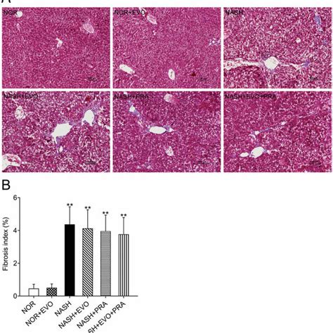 Assessment Of Liver Fibrosis In The Different Experimental Groups By