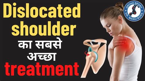 Dislocated Shoulder का सबसे अच्छा Treatment Best Treatment For