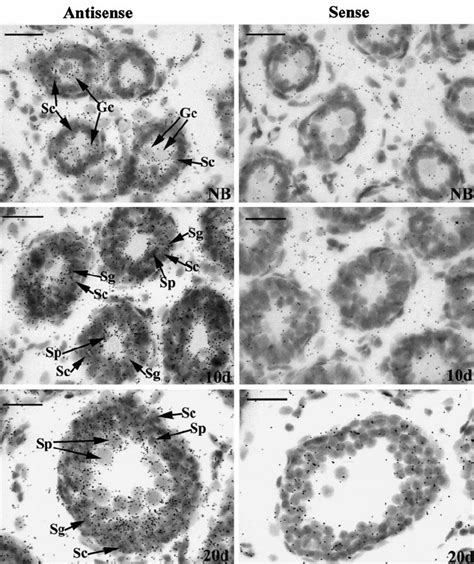 Localization Of Bcl W Mrna In The Immature Rat Testis In Situ Download Scientific Diagram