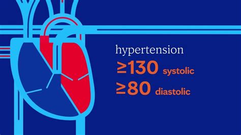 Infographic Systemic Arterial Hypertension Doctors Without Waiting Rooms